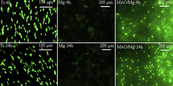 Cytotoxic Effects of Biodegradation of Pure Mg and MAO-Mg on Tumor ...